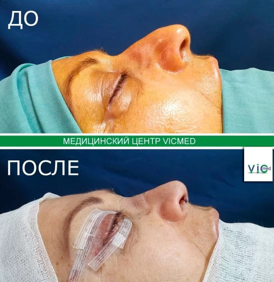 Dr. Ashot Torosyan plastic surgeon